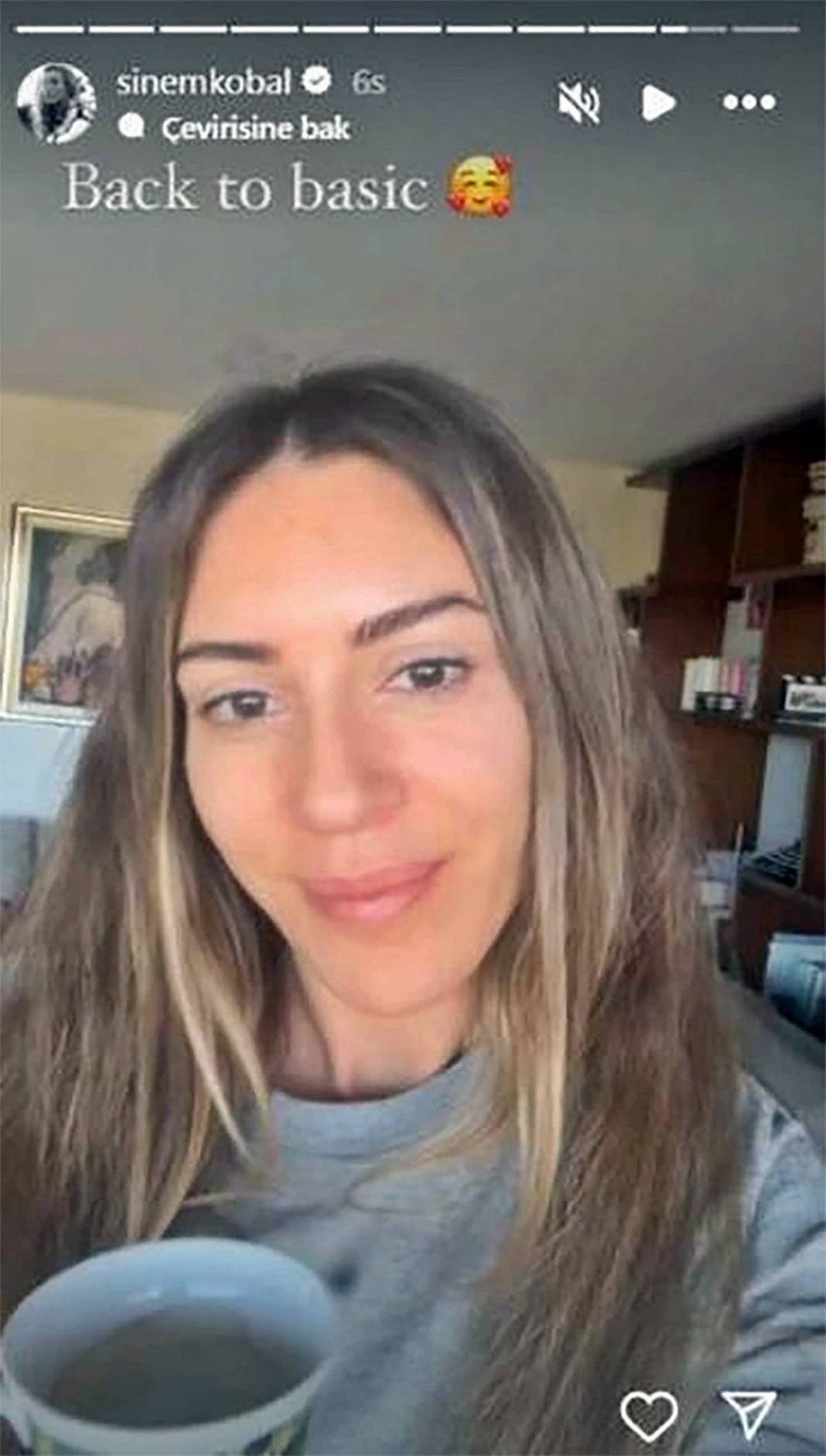 Sinem Kobal'dan 'Çene estetiği yaptırdı' iddialarına şaşırtan yanıt ...