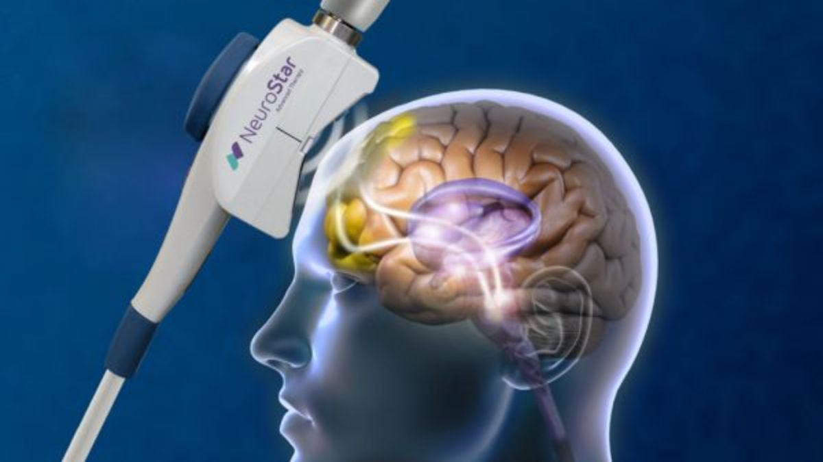 TMS tedavisi nedir?