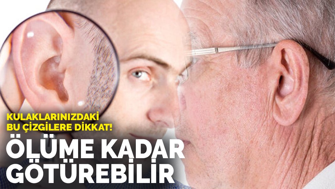 Kulaklarınızdaki bu çizgilere dikkat! Ölüme kadar götürebilir - KARAR