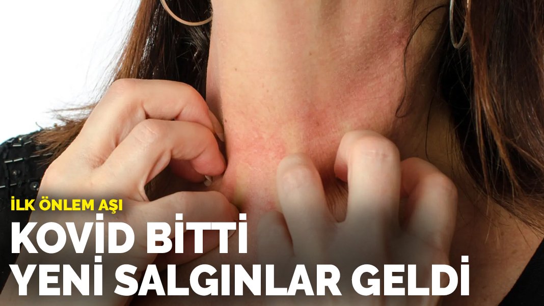 Kovid bitti yeni salgınlar geldi: İlk önlem aşı - KARAR