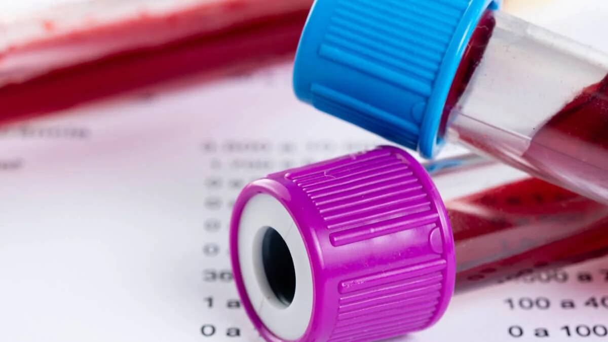 Tam kan sayımı testi nedir?